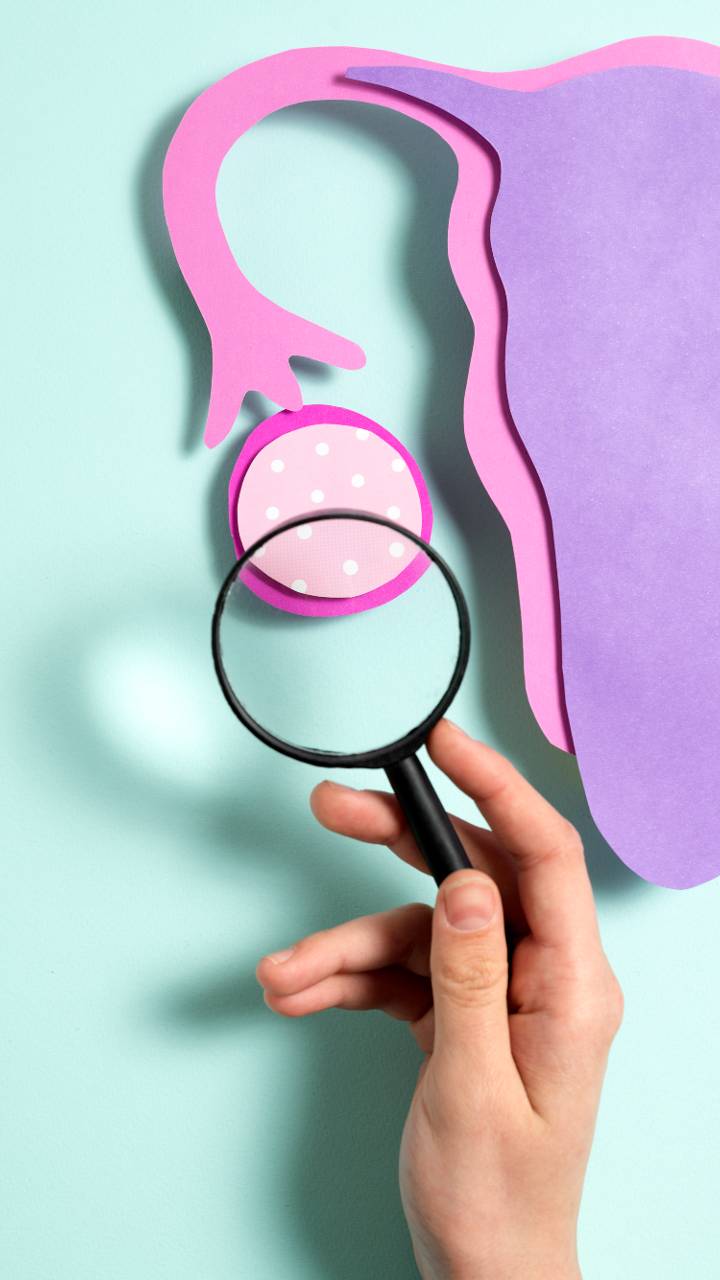 Lifestyle Changes for Natural Conception with PCOS